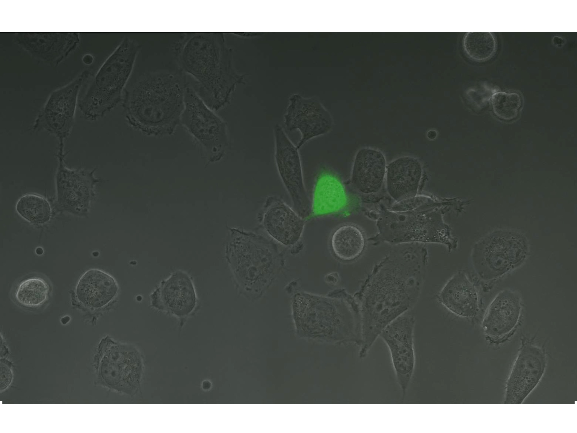 Fifty Years of Reverse Transcriptase - Thierry Heidmann - Retroelements ...